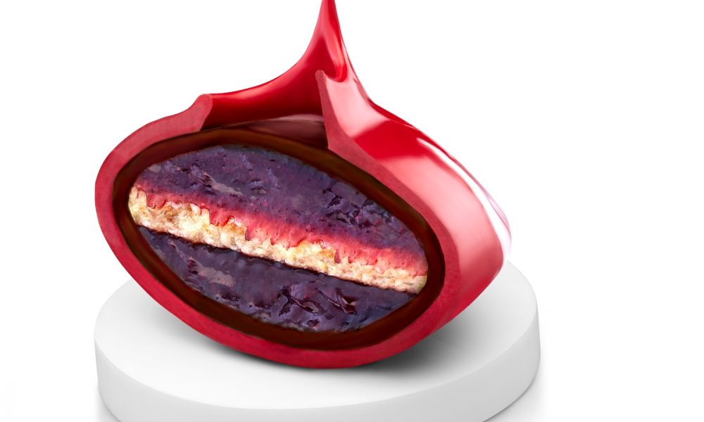 ITC’s Fabelle Exquisite Chocolates ‘Trinity – Truffles Extraordinaire ...